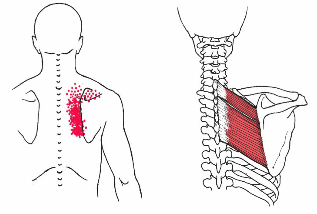Rhomboid Muscle Pain | How To Fix Pain In Shoulder Blade