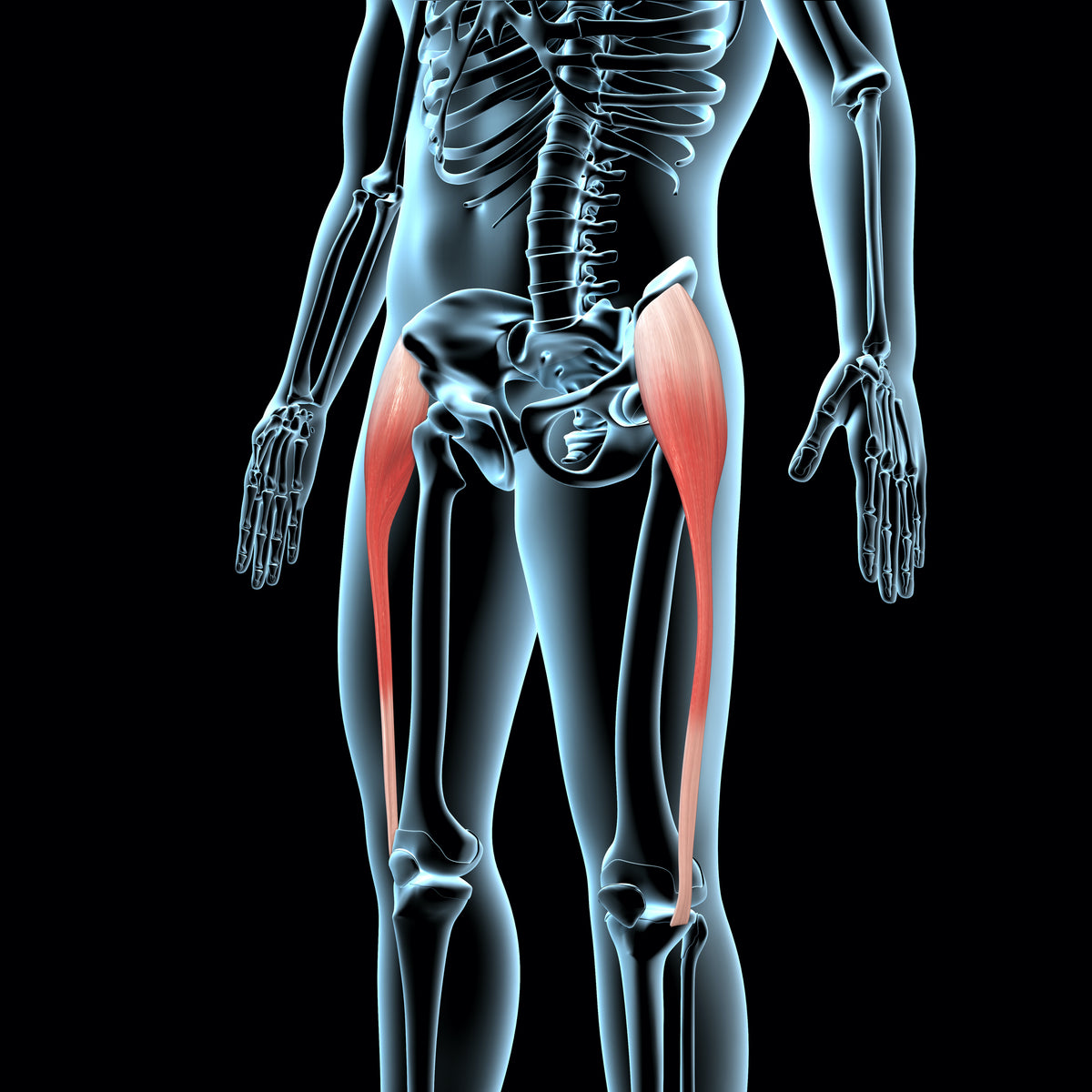 IT Band Tightness - TFL Muscle Culprit